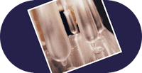 History of Durex | Durex ME